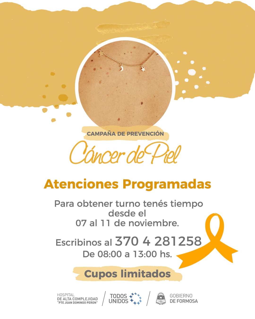 Campaña de Prevención del Cáncer de Piel – Hospital de Alta Complejidad